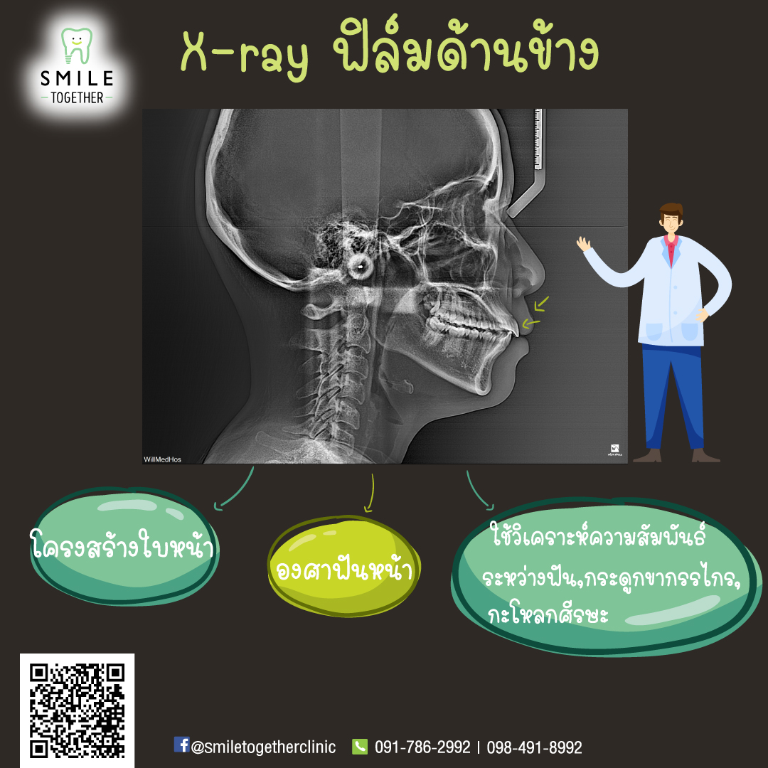 ทำไมต้อง X-ray ? - Smile Together Clinic